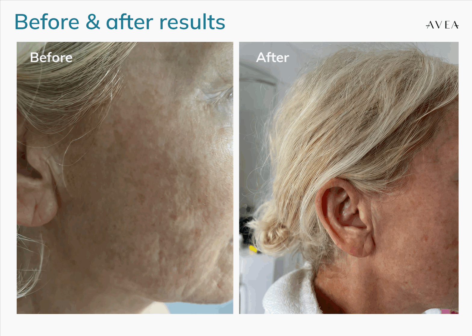 AVEA Collagen Activator Review: Science & Results Explained